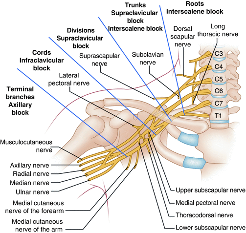 Brachial Plexus, Axillary, and Suprascapular Nerve Block – Chart Talk ...